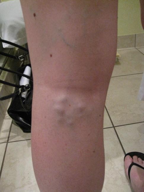 Veins - Dover Shores Family Practice